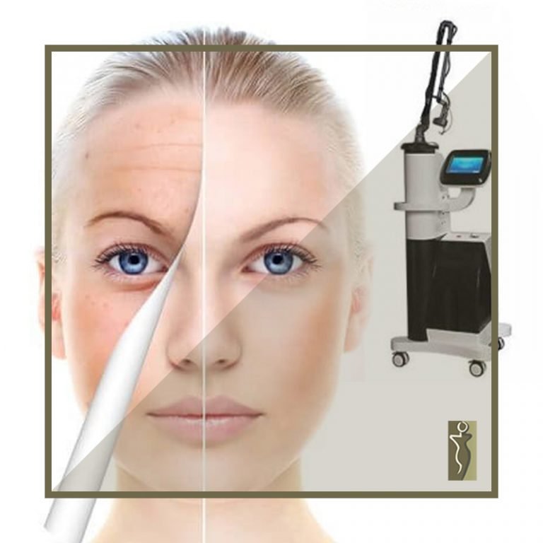 Laser | Πλαστικός Χειρουργός | Dr. Τσέπουρας Σωτήριος | Θεσσαλονίκη